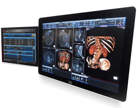 El RIS y su impacto en un servicio de radiología