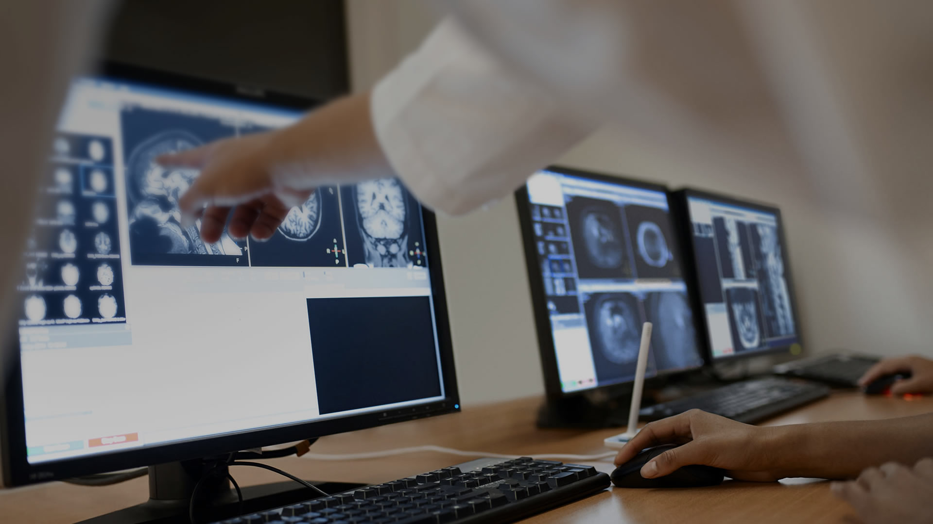 ¿Por qué implementar un PACS?